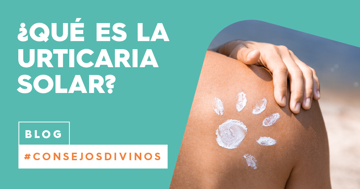 ¿Qué es la urticaria solar y qué tratamiento tiene?